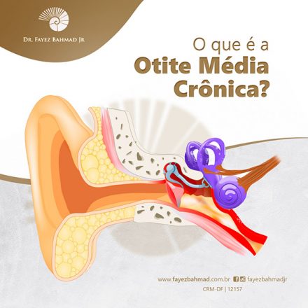 O que é Otite Média Crônica? – Dr. Fayez Bahmad